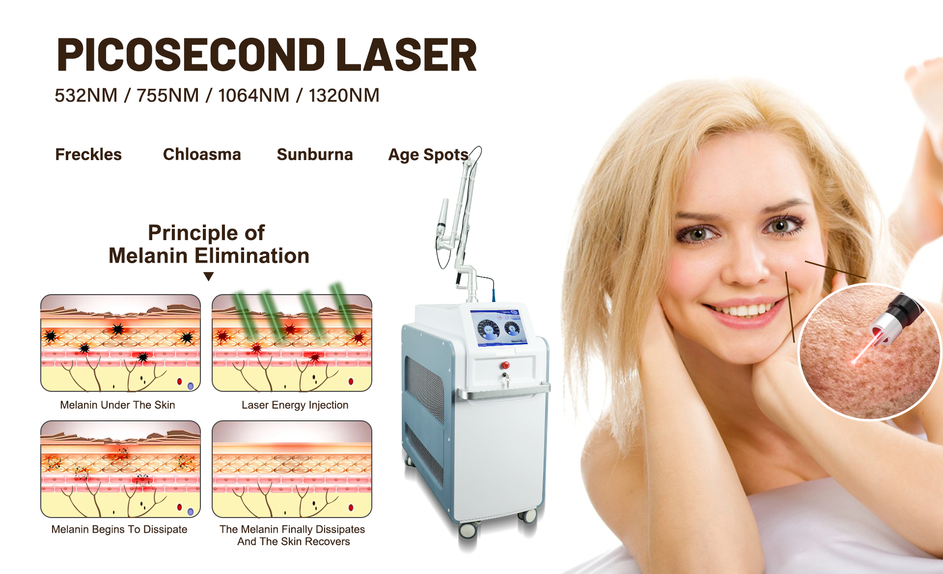 Picosecond Laser vs. Other Lasers: Best Choice for Your Skin ...